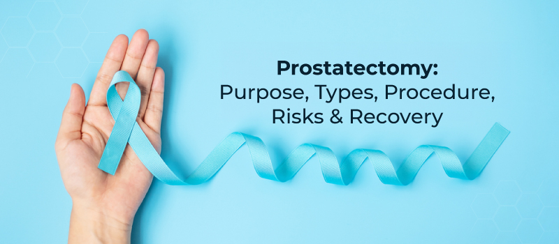 Prostatectomy: Purpose, Types, Procedure, Risks & Recovery | AINU
